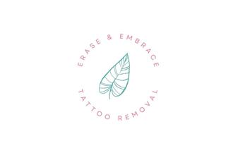 Erase and Embrace Tattoo Removal - Temecula CA | Vagaro